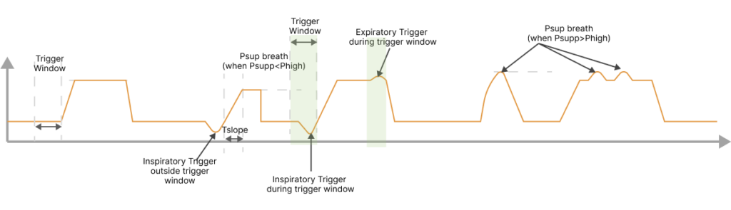 Mechanical Ventilation - Advance Ventilation Modes - Vensi - Smart ...
