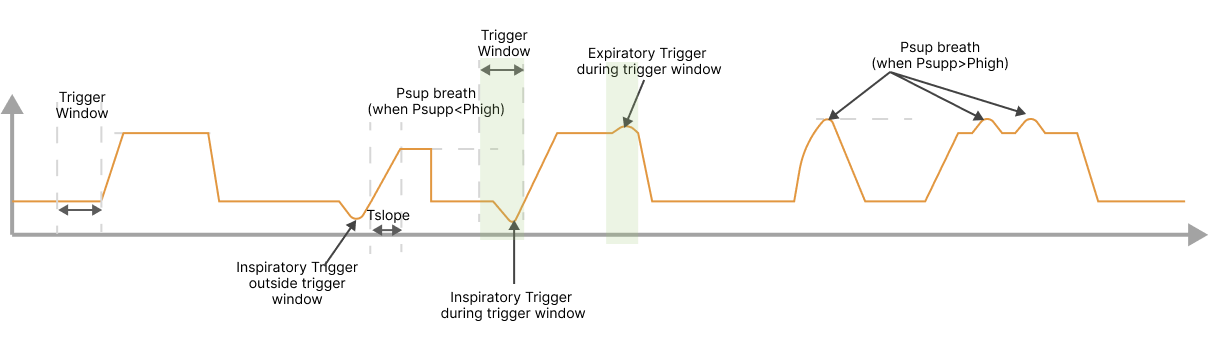 Mechanical Ventilation - Advance Ventilation Modes - Vensi - Smart ...