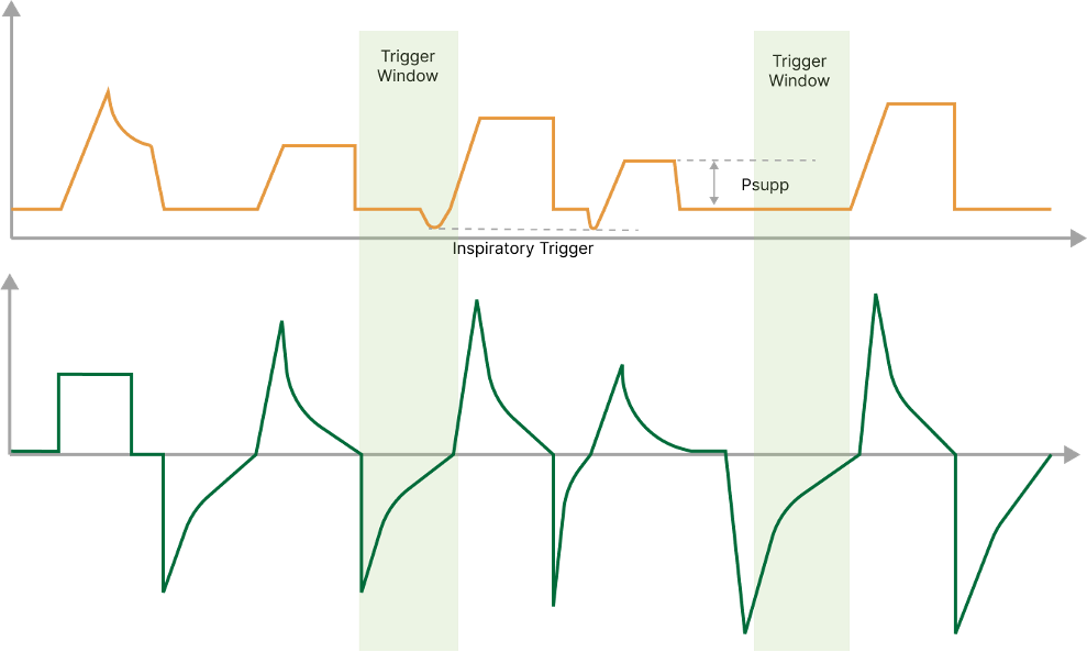 Mechanical Ventilation - Advance Ventilation Modes - Vensi - Smart ...
