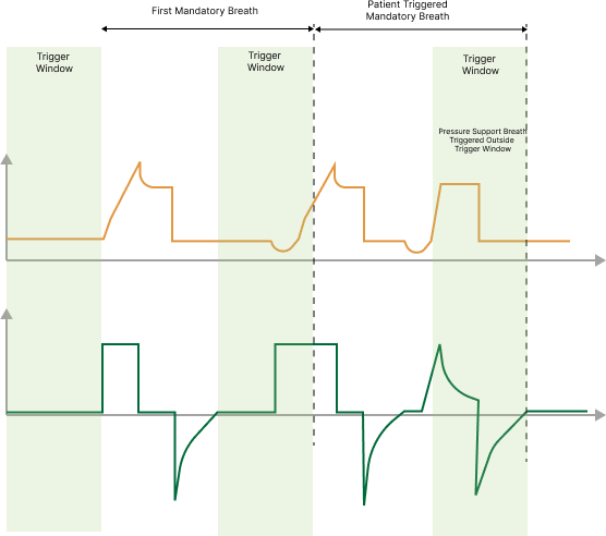 Mechanical Ventilation- Basic Ventilation Modes - Vensi - Smart ...