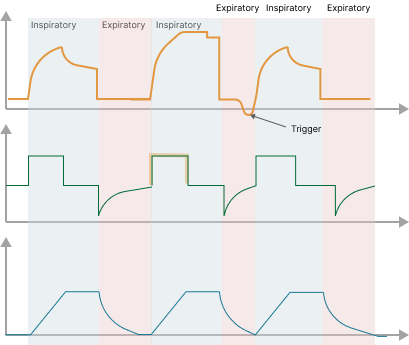 Mechanical Ventilation- Basic Ventilation Modes - Vensi - Smart ...