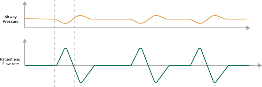 Mechanical Ventilation - Advance Ventilation Modes - Vensi - Smart ...
