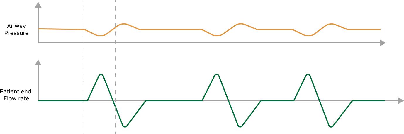 Mechanical Ventilation - Advance Ventilation Modes - Vensi - Smart ...